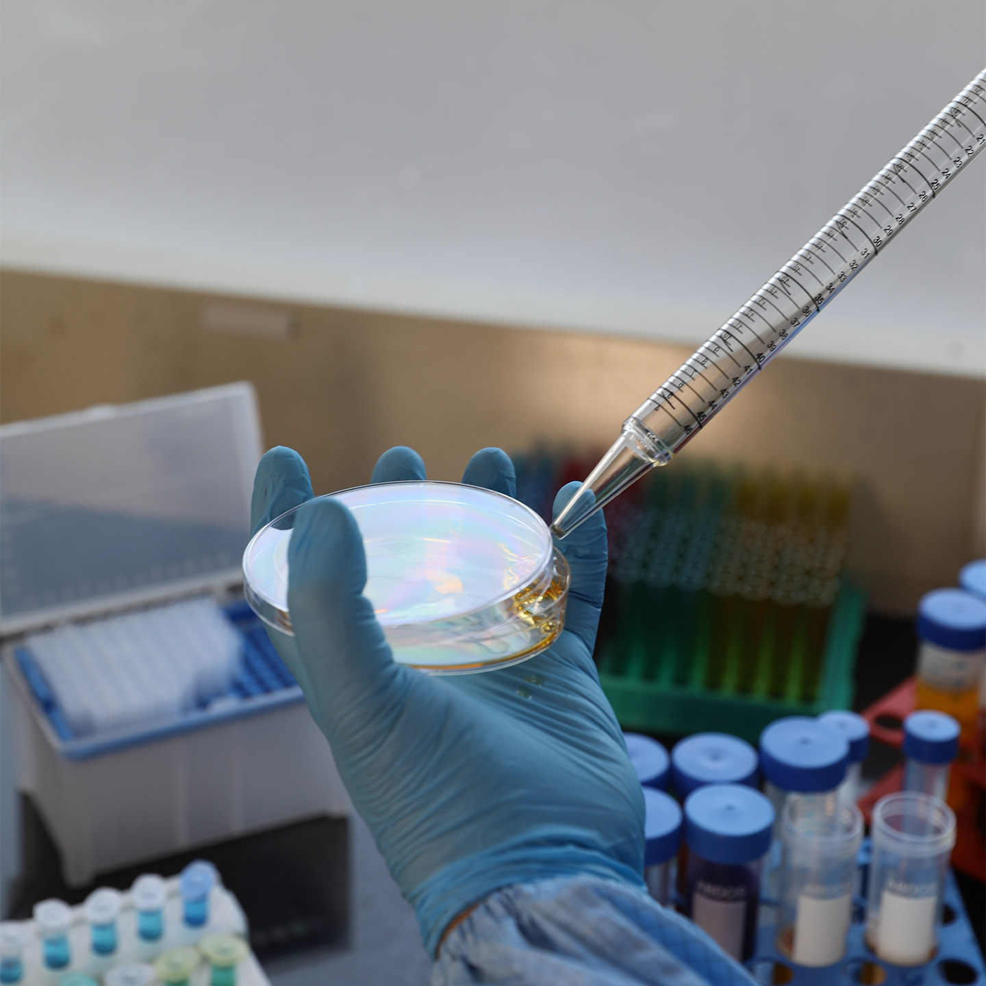 Basic Techniques of Aseptic handling in a Microbiology Labs - Abdos